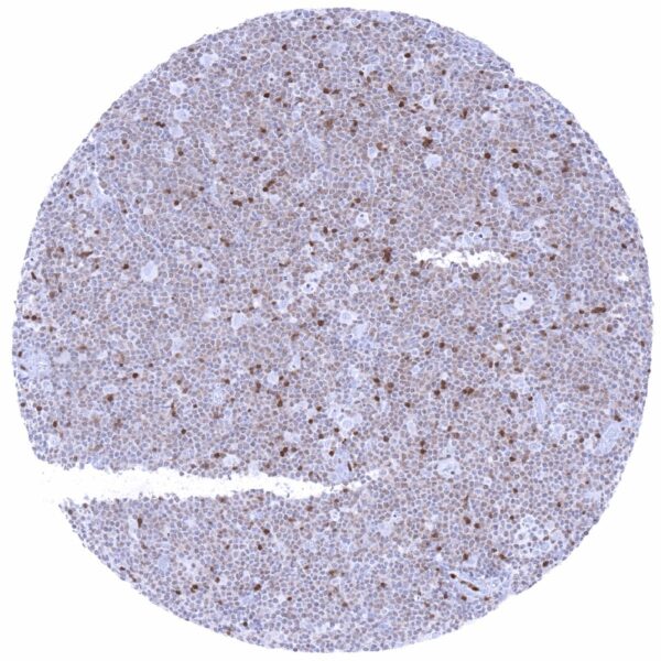 Cancer Tissue Gallery ZAP-70 - MS Validated Antibodies