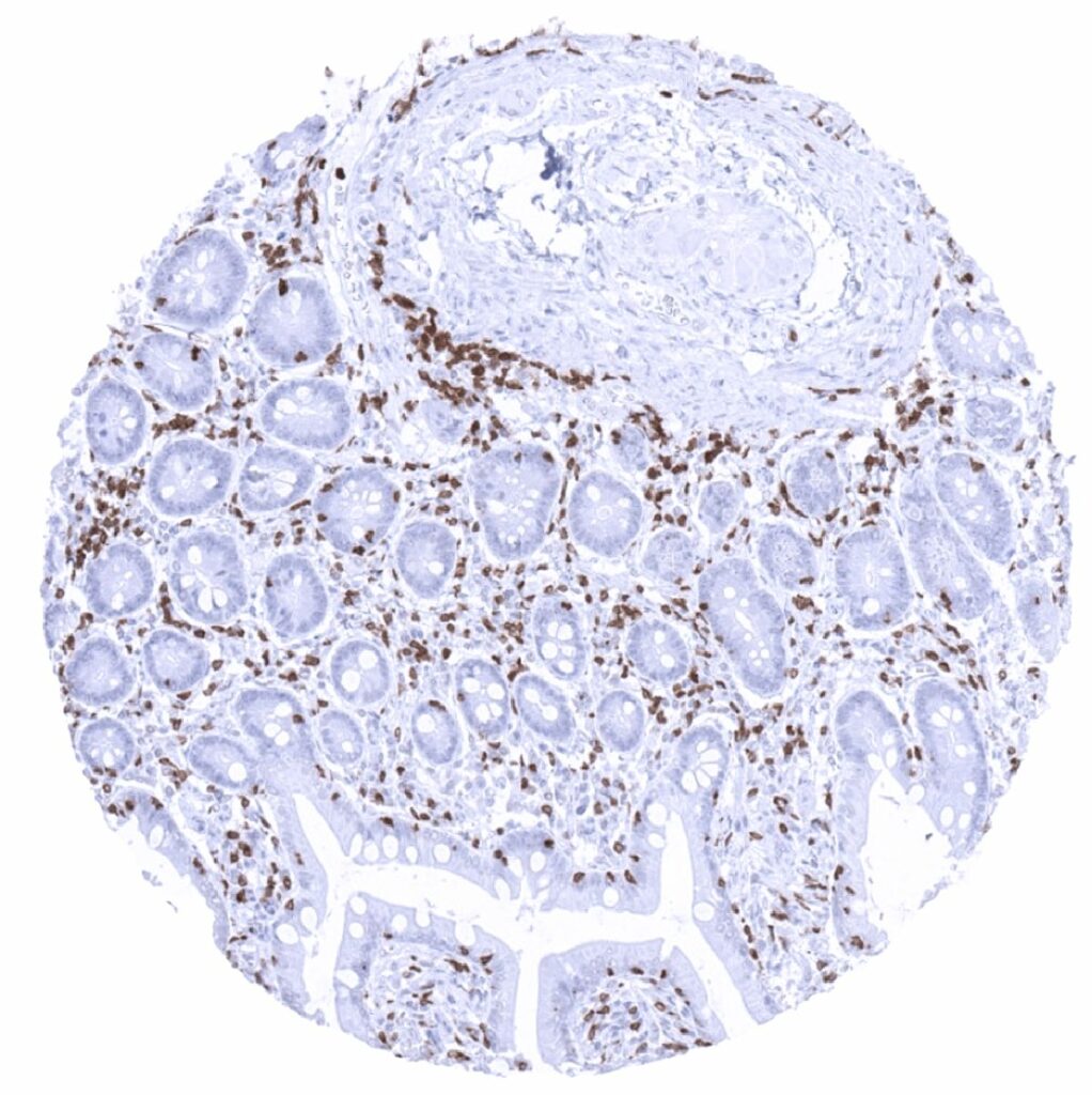 ZAP-70 (MSVA-870R) - MS Validated Antibodies