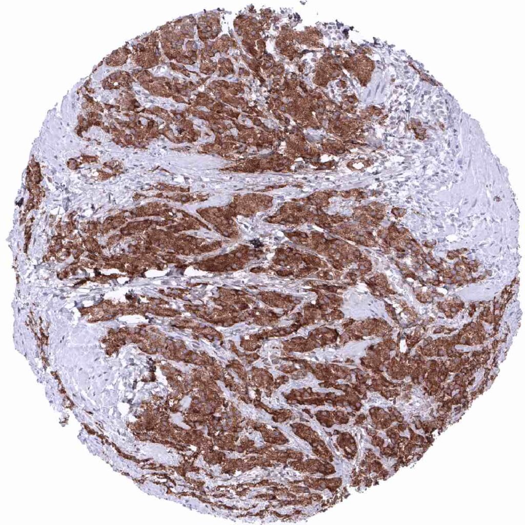 PSA (MSVA-603R) - MS Validated Antibodies