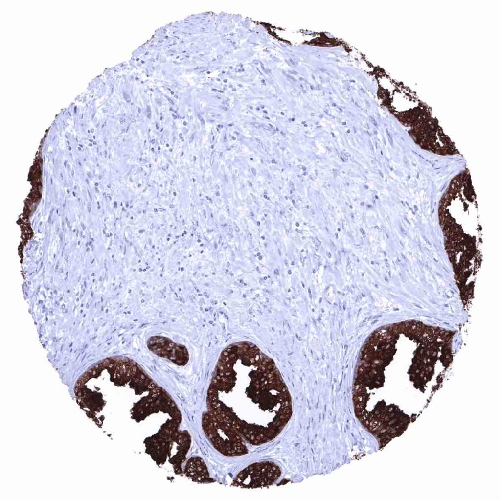 PSA (MSVA-603R) - MS Validated Antibodies