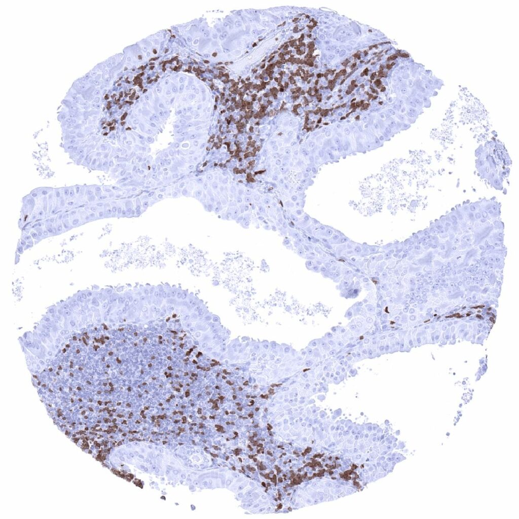 ZAP-70 (MSVA-870R) - MS Validated Antibodies