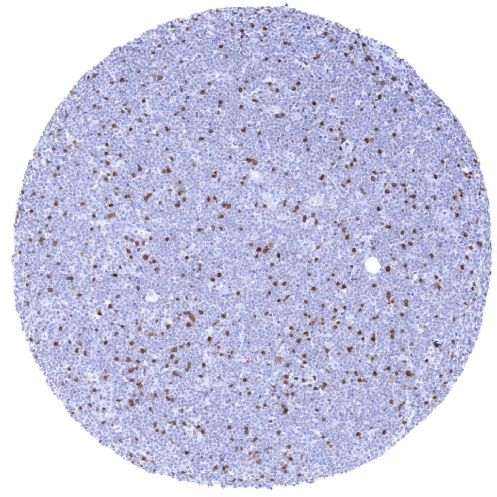 ZAP-70 (MSVA-870R) - MS Validated Antibodies