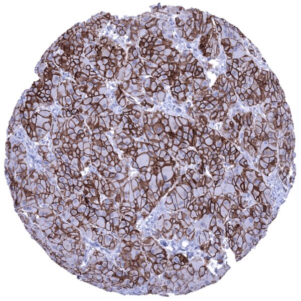 Cancer Tissue Gallery CD56 - MS Validated Antibodies