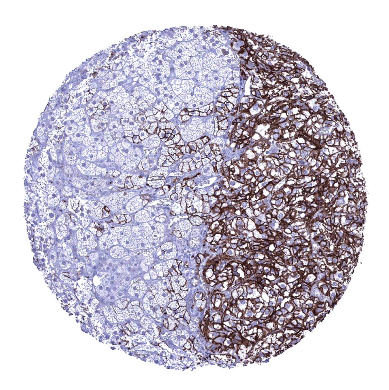 Normal Tissue Gallery CD56 - MS Validated Antibodies