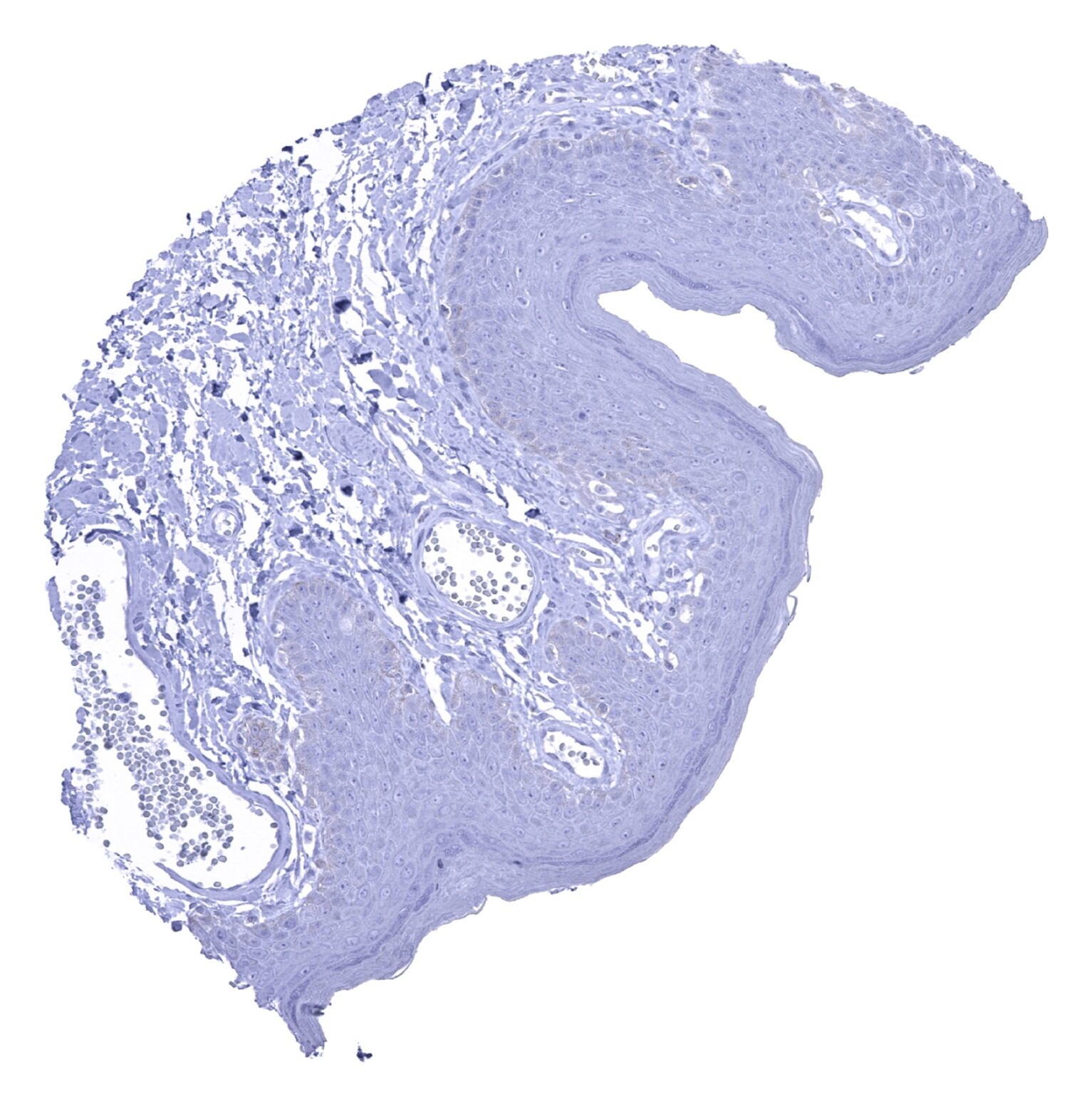 Normal Tissue Gallery Cadherin-17 / CDH17 - MS Validated Antibodies
