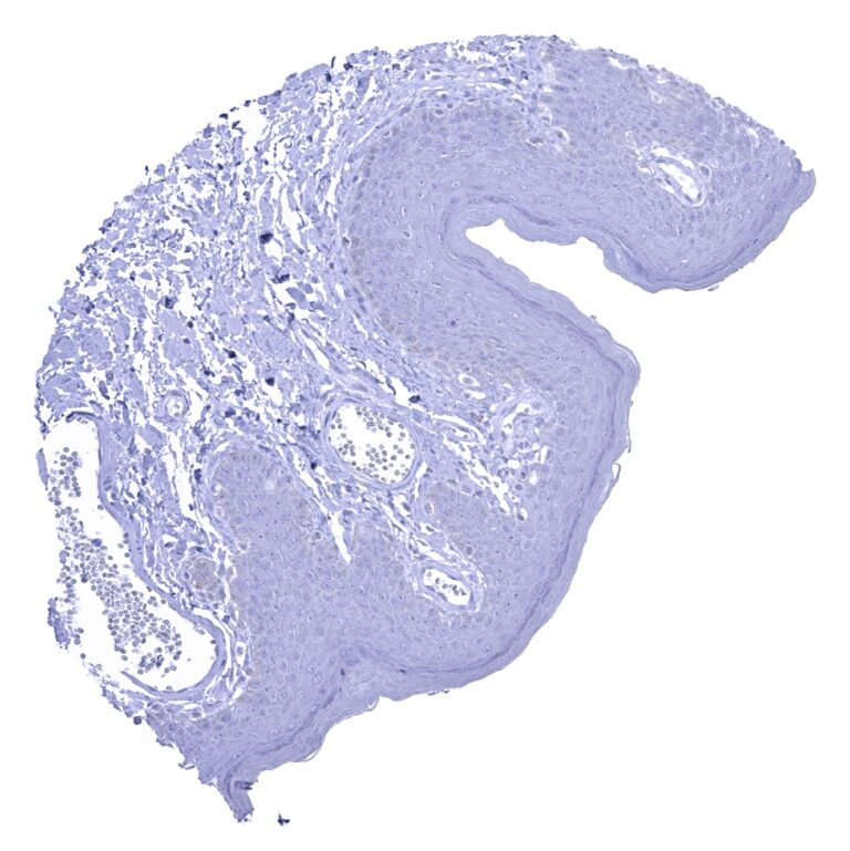 Normal Tissue Gallery Cadherin-17 / CDH17 - MS Validated Antibodies