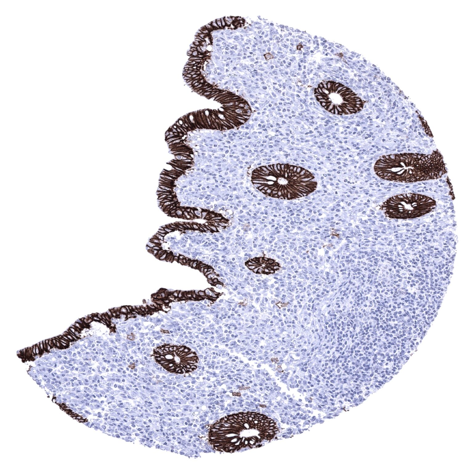 Normal Tissue Gallery Cadherin-17 / CDH17 - MS Validated Antibodies
