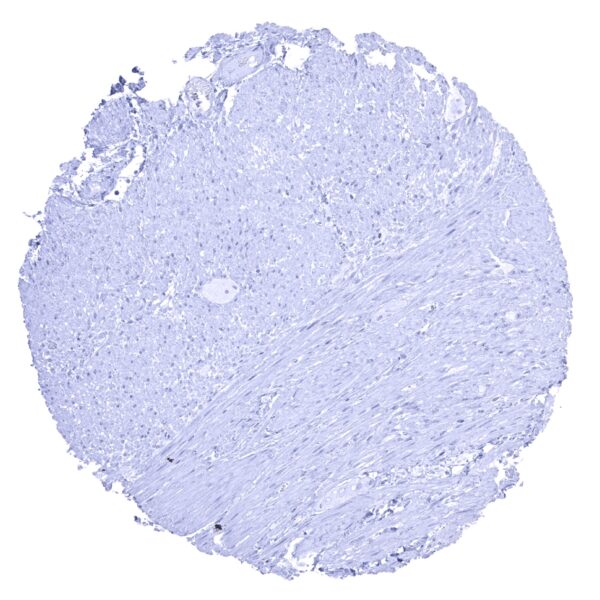 Normal Tissue Gallery Cadherin-17 / CDH17 - MS Validated Antibodies