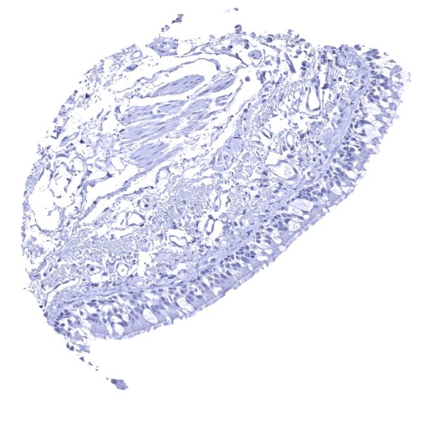 Normal Tissue Gallery Cadherin-17 / CDH17 - MS Validated Antibodies