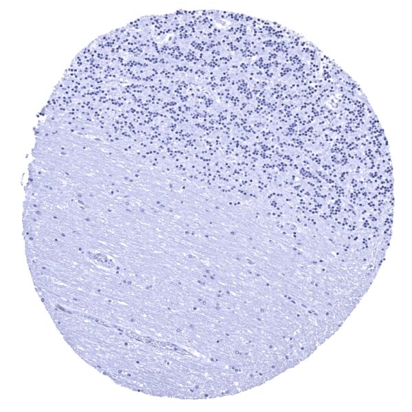 Normal Tissue Gallery Cadherin-17 / CDH17 - MS Validated Antibodies