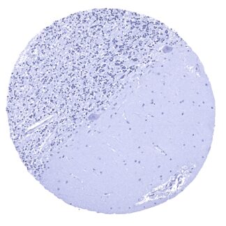 Normal Tissue Gallery Cadherin-17 / CDH17 - MS Validated Antibodies