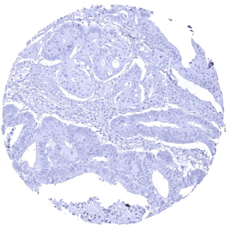 Cancer Tissue Gallery CD56 - MS Validated Antibodies