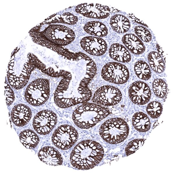 Normal Tissue Gallery Cadherin-17 / CDH17 - MS Validated Antibodies