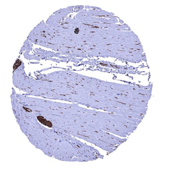 Normal Tissue Gallery CD56 - MS Validated Antibodies