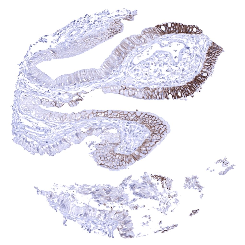 Cadherin-17 / CDH17 (MSVA-517M) - MS Validated Antibodies