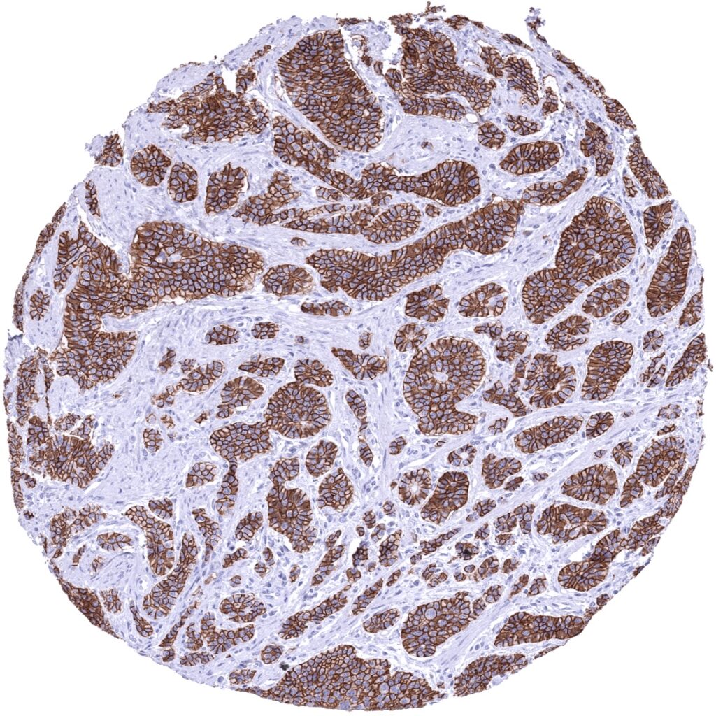 Cadherin-17 / CDH17 (MSVA-517M) - MS Validated Antibodies