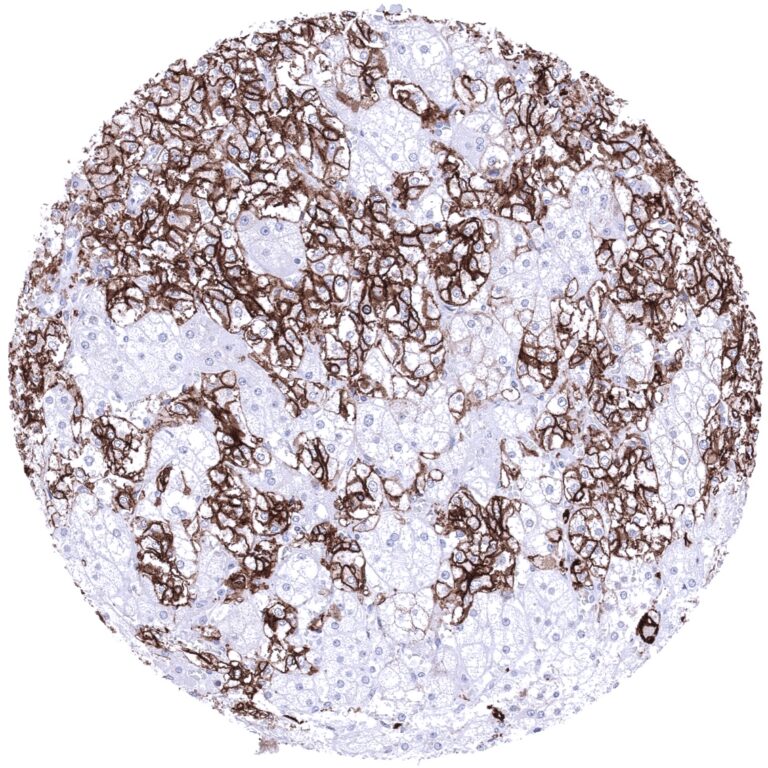 Cancer Tissue Gallery CD56 - MS Validated Antibodies