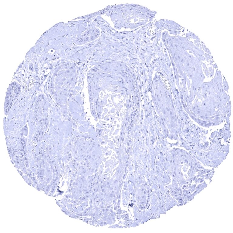 Cancer Tissue Gallery CD56 - MS Validated Antibodies