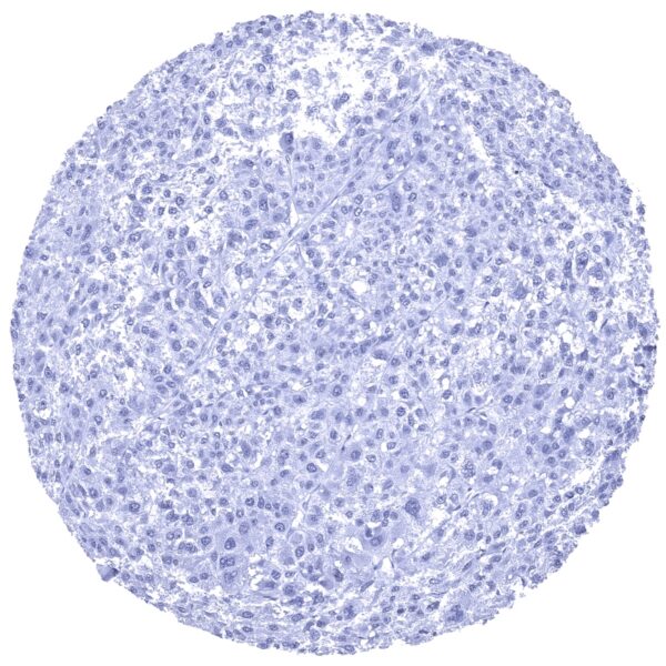 Cancer Tissue Gallery CD56 - MS Validated Antibodies