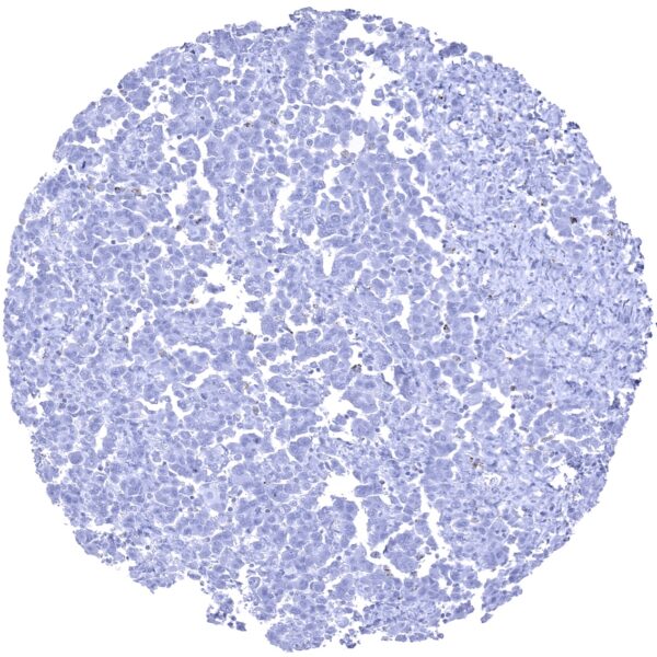 Cancer Tissue Gallery CD56 - MS Validated Antibodies