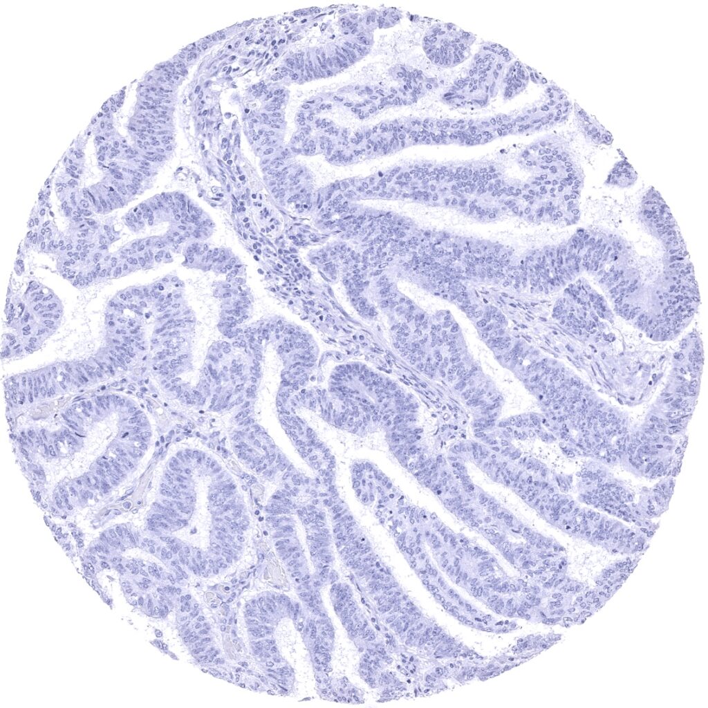Cadherin-17 / CDH17 (MSVA-517M) - MS Validated Antibodies