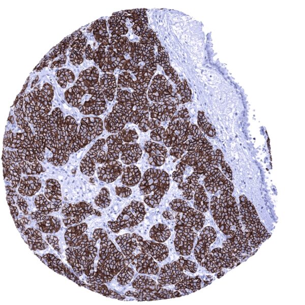 Cancer Tissue Gallery CD56 - MS Validated Antibodies