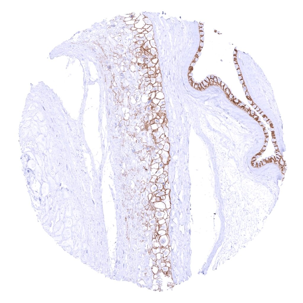 E-Cadherin (MSVA-035R) - MS Validated Antibodies