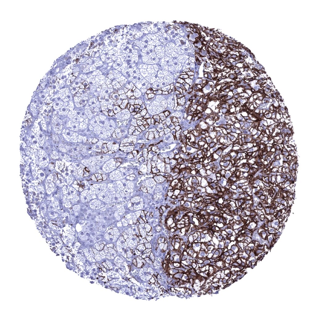 CD56 (MSVA-056R) - MS Validated Antibodies