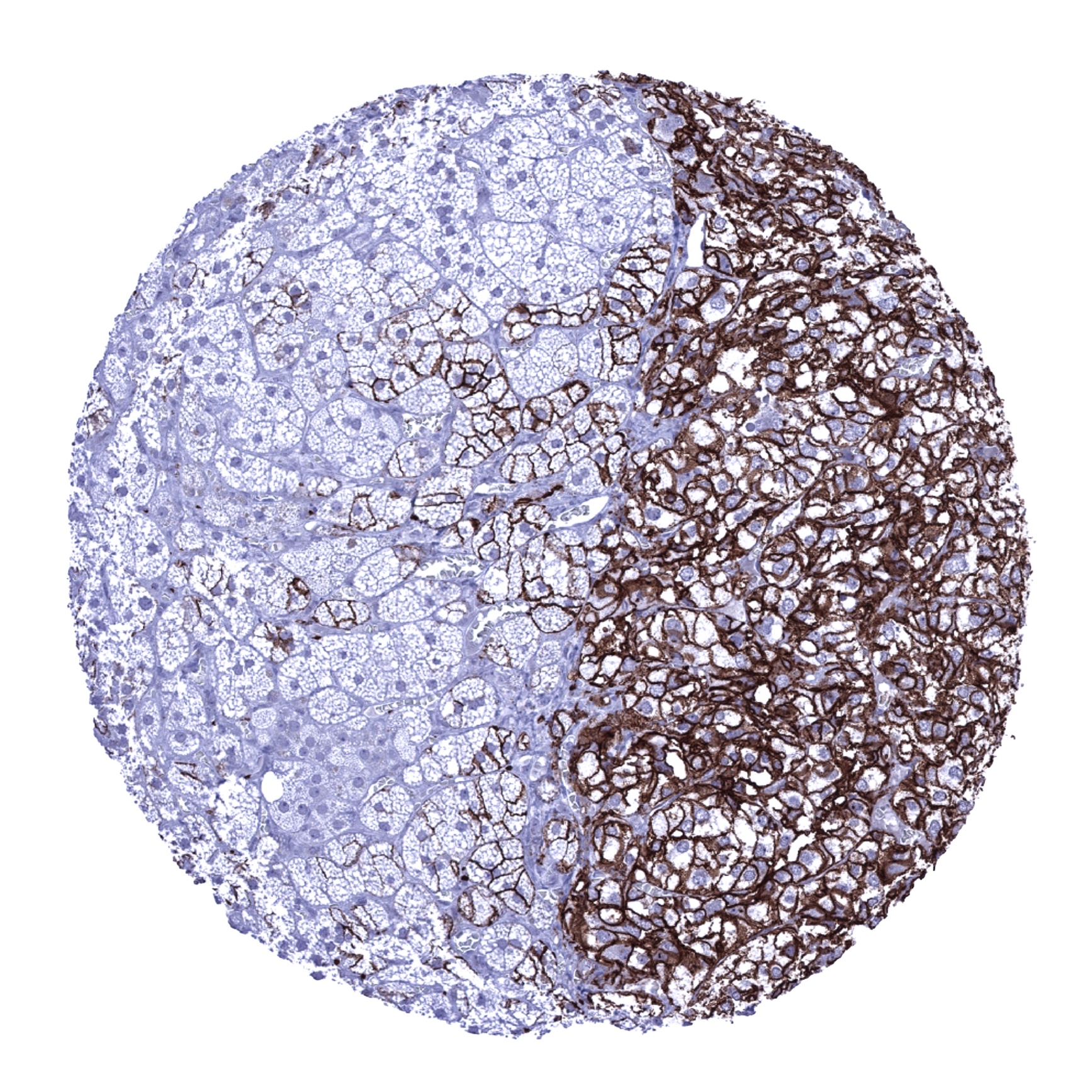 CD56 (MSVA-056R) - MS Validated Antibodies