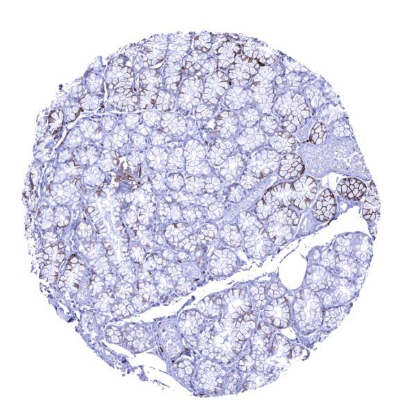 CD56 (MSVA-056R) - MS Validated Antibodies