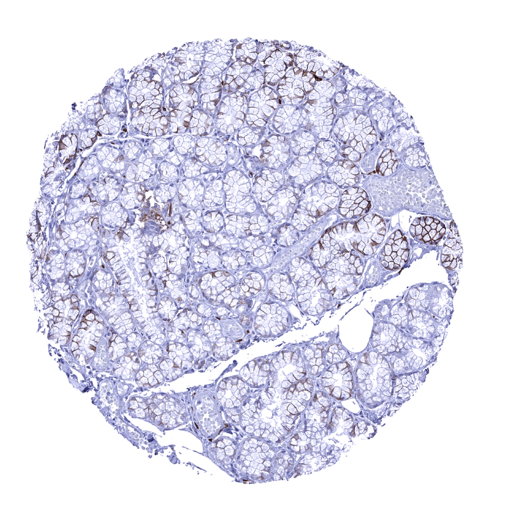 CD56 (MSVA-056R) - MS Validated Antibodies