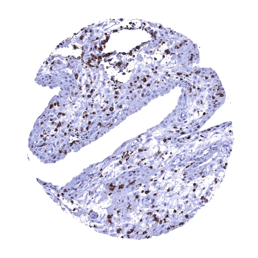 CD56 (MSVA-056R) - MS Validated Antibodies