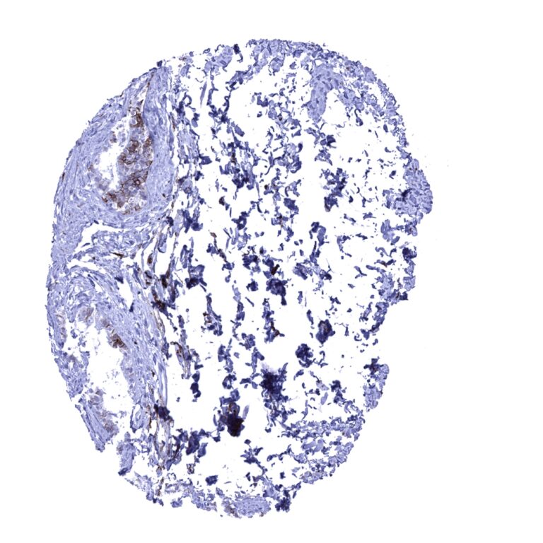 CD56 (MSVA-056R) - MS Validated Antibodies