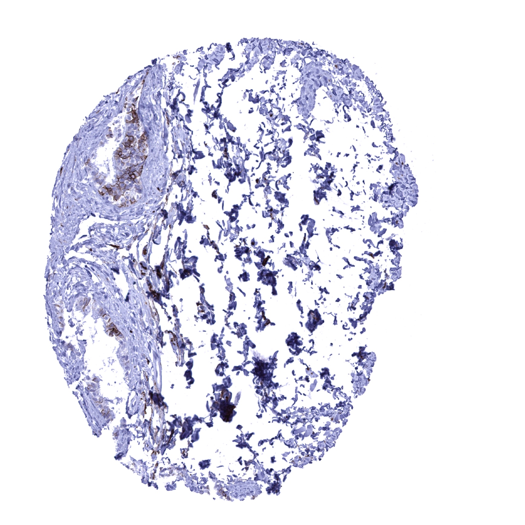 CD56 (MSVA-056R) - MS Validated Antibodies