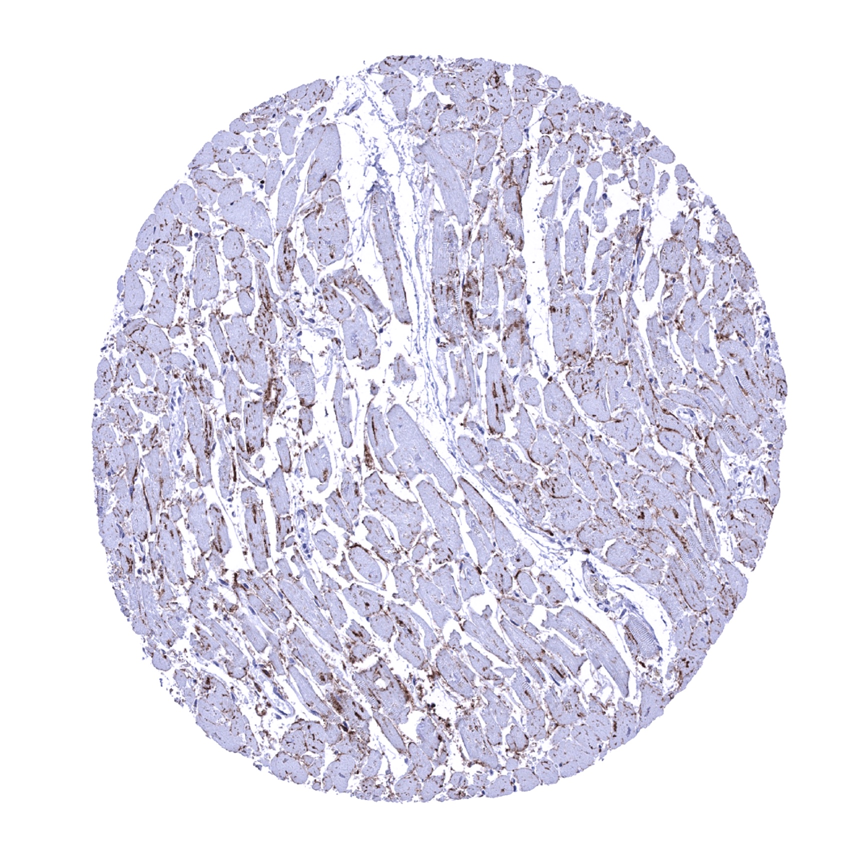CD56 (MSVA-056R) - MS Validated Antibodies