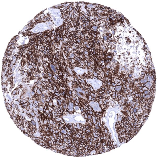 CD56 (MSVA-056R) - MS Validated Antibodies