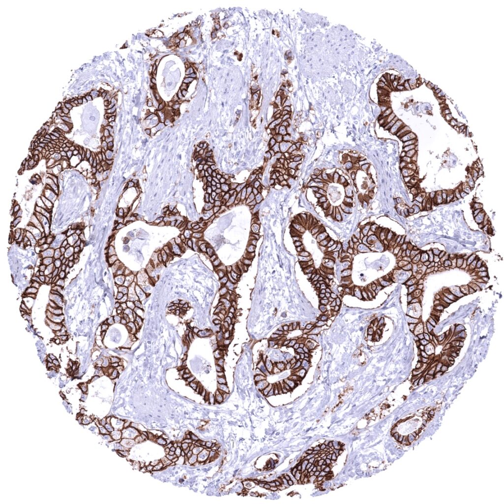 Cadherin-17 / CDH17 (MSVA-517M) - MS Validated Antibodies