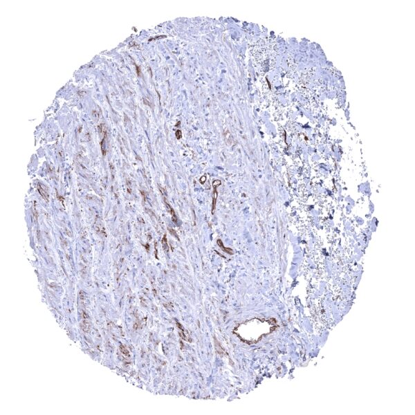 Normal Tissue Gallery CD141 - MS Validated Antibodies