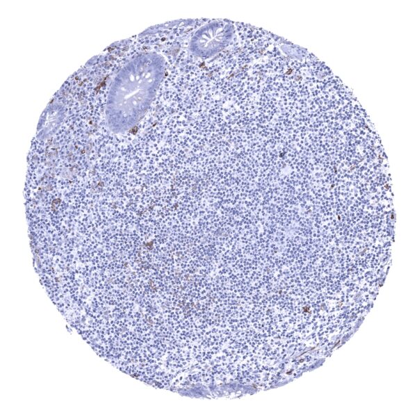 Normal Tissue Gallery CD141 - MS Validated Antibodies