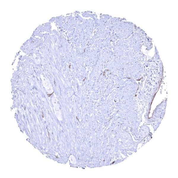 Normal Tissue Gallery CD141 - MS Validated Antibodies