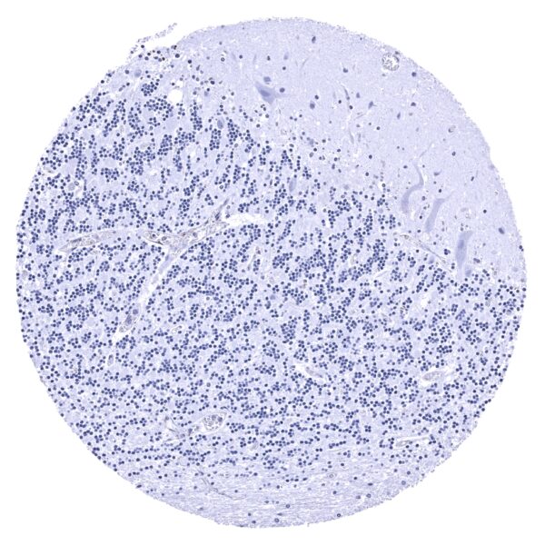 Normal Tissue Gallery CD141 - MS Validated Antibodies