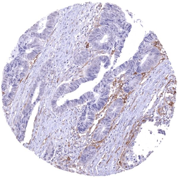 Cancer Tissue Gallery CD141 - MS Validated Antibodies