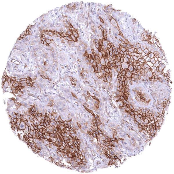 Cancer Tissue Gallery CD141 - MS Validated Antibodies