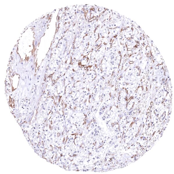 Cancer Tissue Gallery CD141 - MS Validated Antibodies