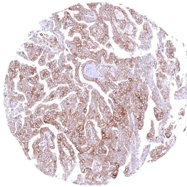 Cancer Tissue Gallery CD141 - MS Validated Antibodies