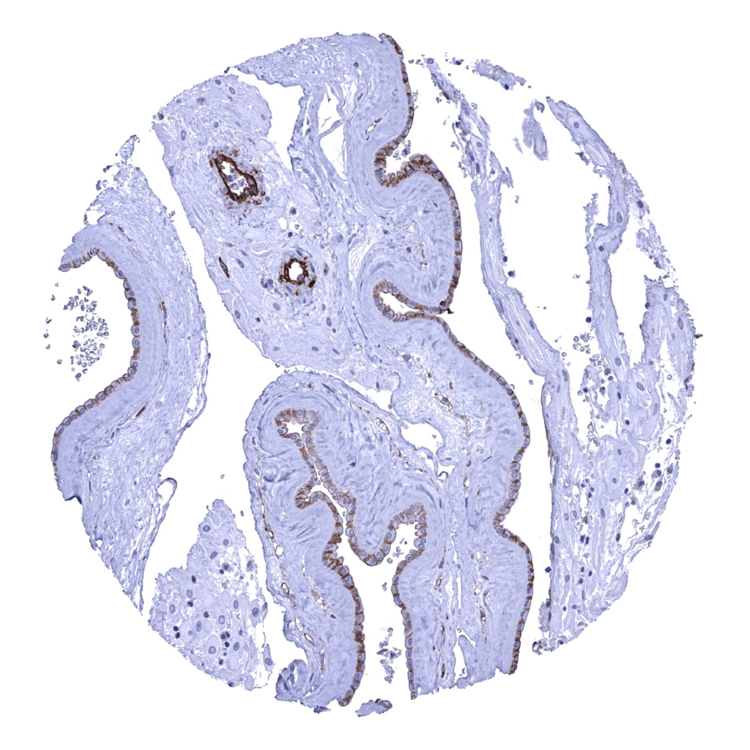 CD141 (MSVA-141M) - MS Validated Antibodies