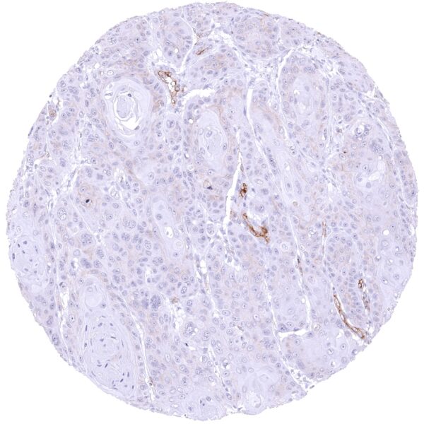Cancer Tissue Gallery CD141 - MS Validated Antibodies