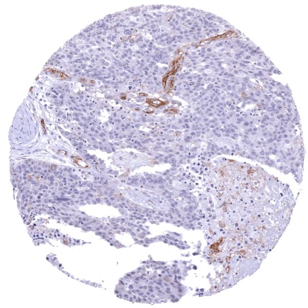 Cancer Tissue Gallery CD141 - MS Validated Antibodies