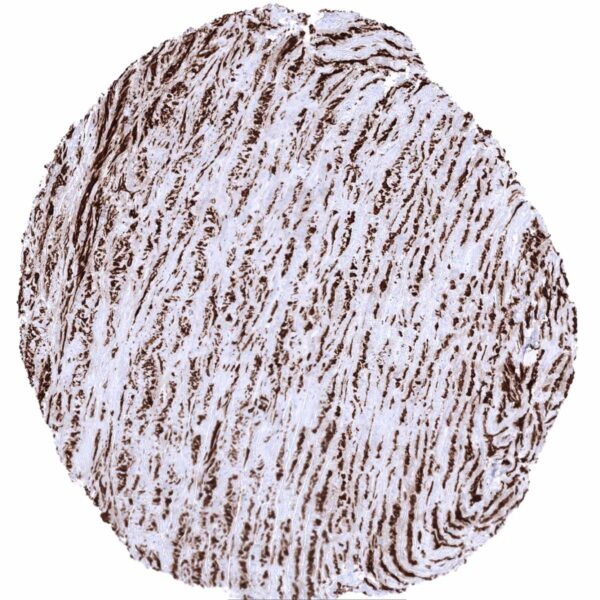 Normal Tissue Gallery Caldesmon - MS Validated Antibodies