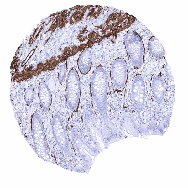 Normal Tissue Gallery Caldesmon - MS Validated Antibodies